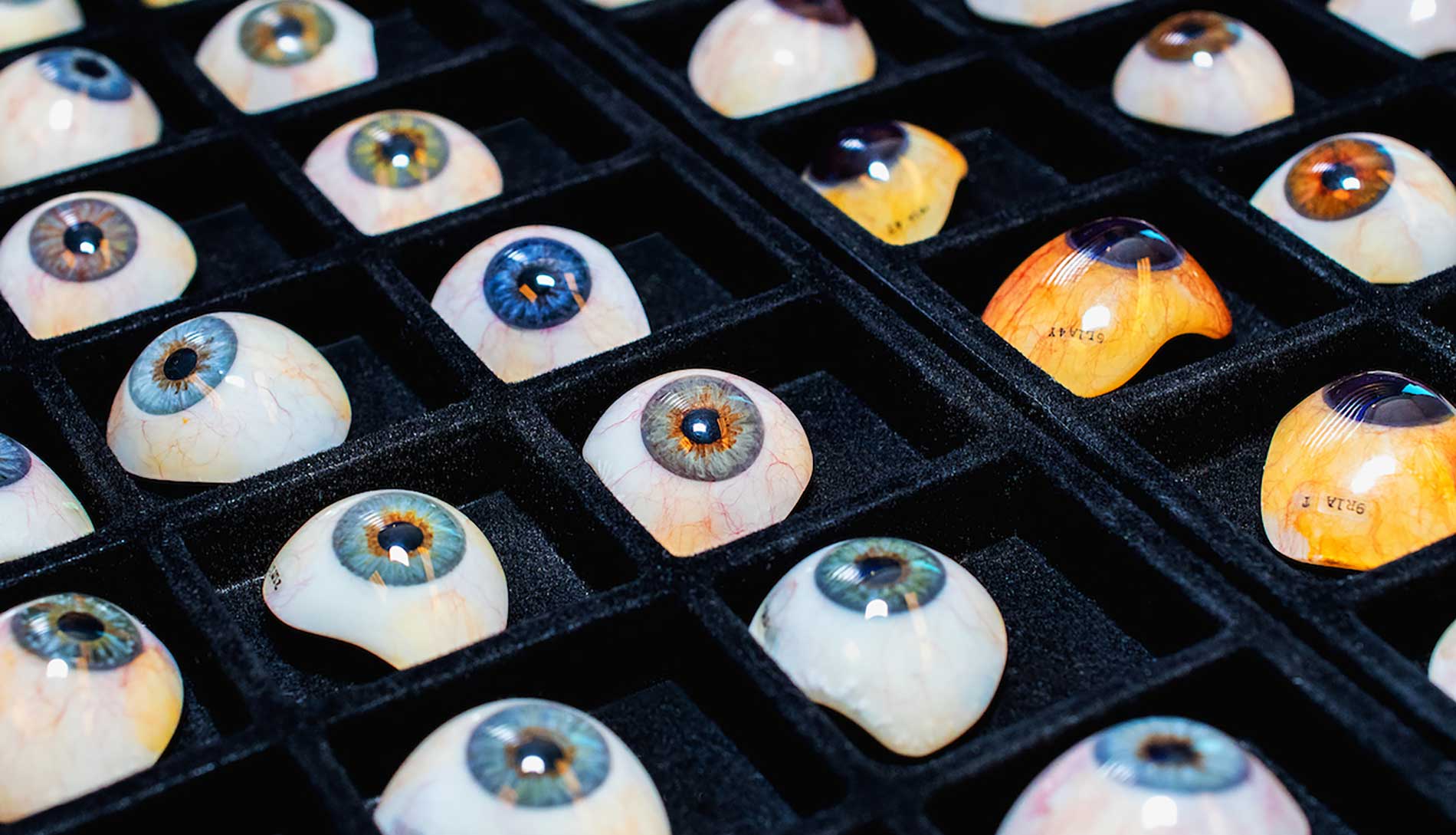 Ocular Prosthetics | Midwestern University Clinics
